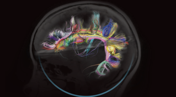 Computational Neuroscience - AI Trends Computational Neuroscience - AI Trends